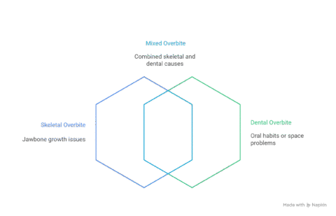 What is a Overbite ? Causes & Treatments